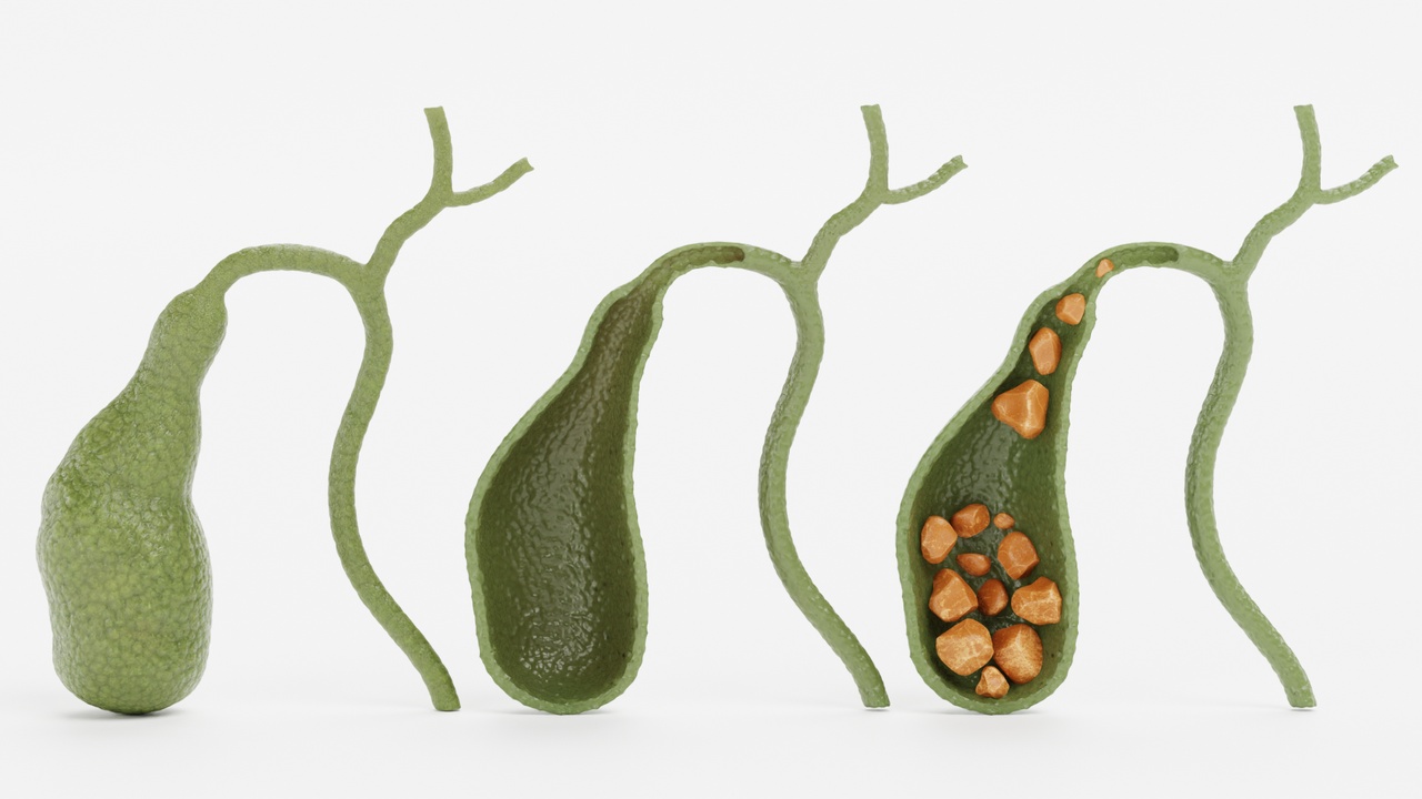 Gallbladder Set - Full Human Organ with Section and Gallstones | Fab