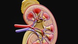 Human Kidney Anatomy Cross Section | Fab